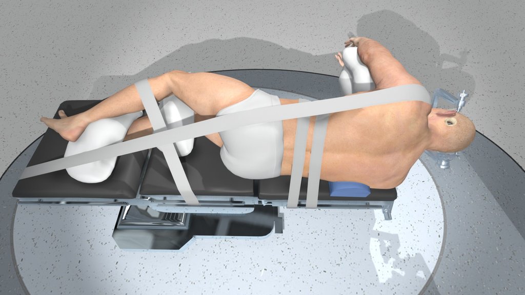 Retromastoid Craniotomy: OR Room Setup - Patient Only | 3D Models | The ...