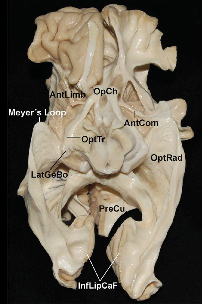 Basal View of the Neural Visual Pathways | Neuroanatomy | The ...