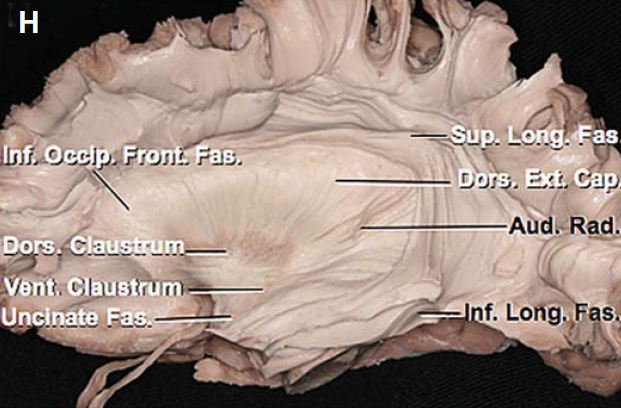 Insular Region | Neuroanatomy | The Neurosurgical Atlas