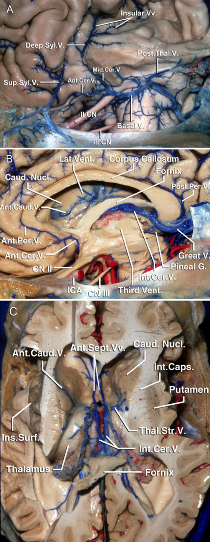 Venous Drainage of the Central Core | Neuroanatomy | The Neurosurgical ...