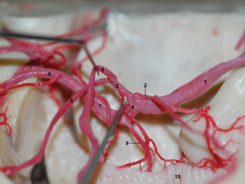 Inferior View of the Common Temporal Artery | Neuroanatomy | The ...