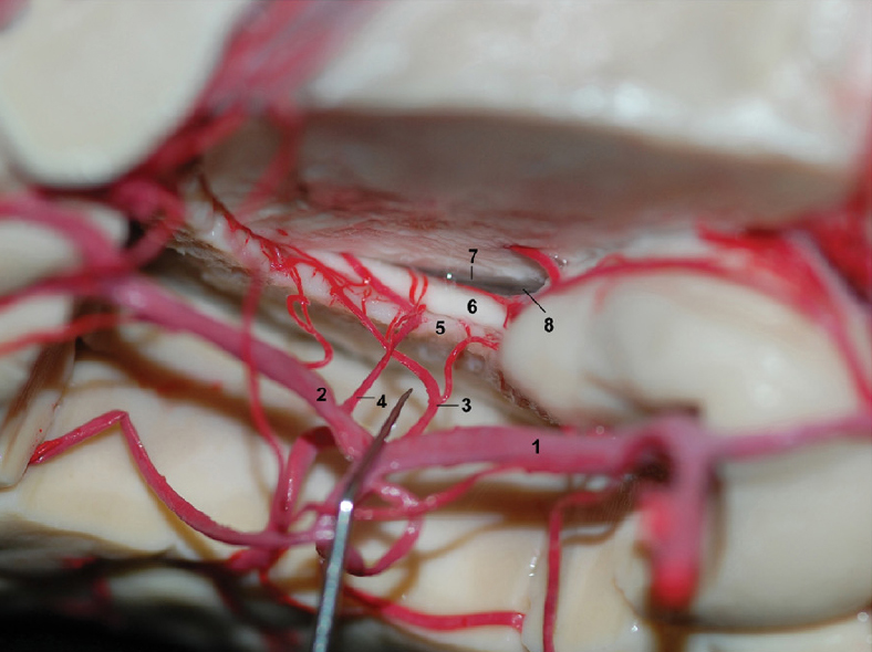View of the Medial Surface of the Left Hemisphere | Neuroanatomy | The ...