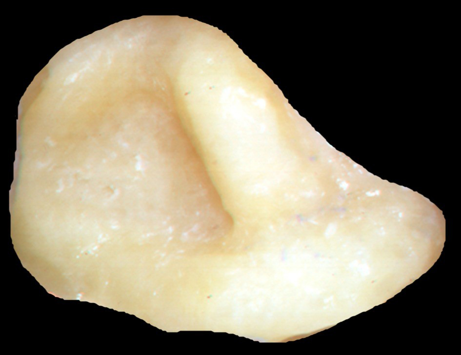 Right Lateral View of Bony Labyrinth | Neuroanatomy | The Neurosurgical ...