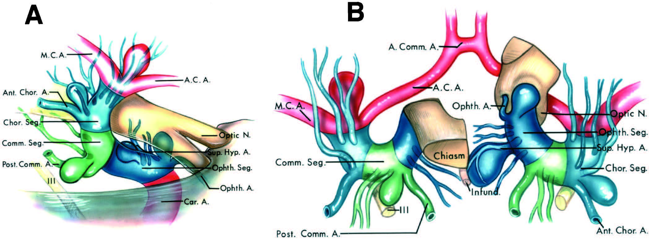 Aneurysms | The Neurosurgical Atlas