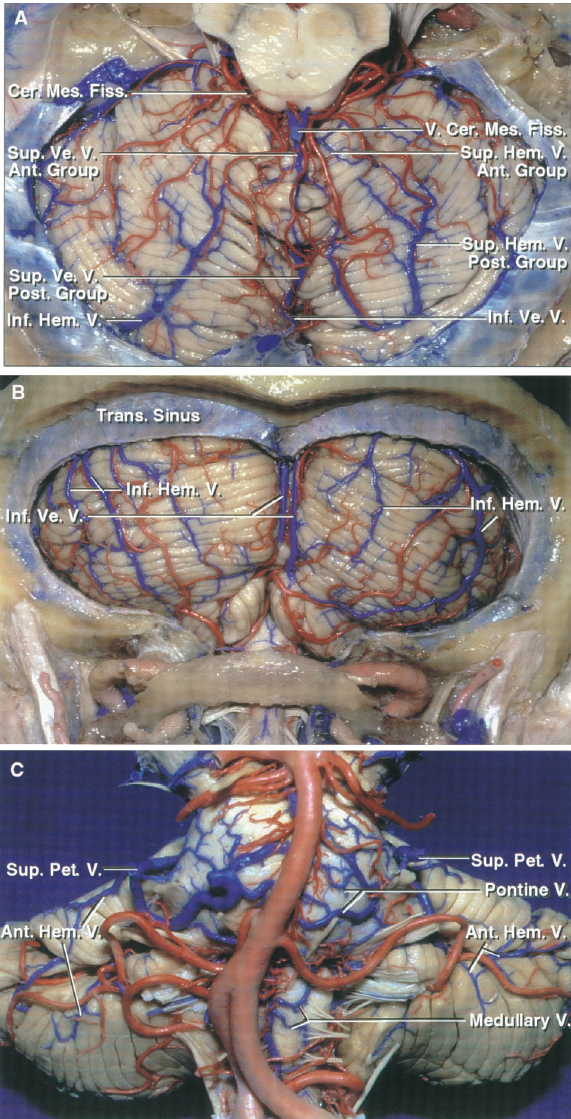 Drainage Patterns of the Cerebellar Surfaces | Neuroanatomy | The ...