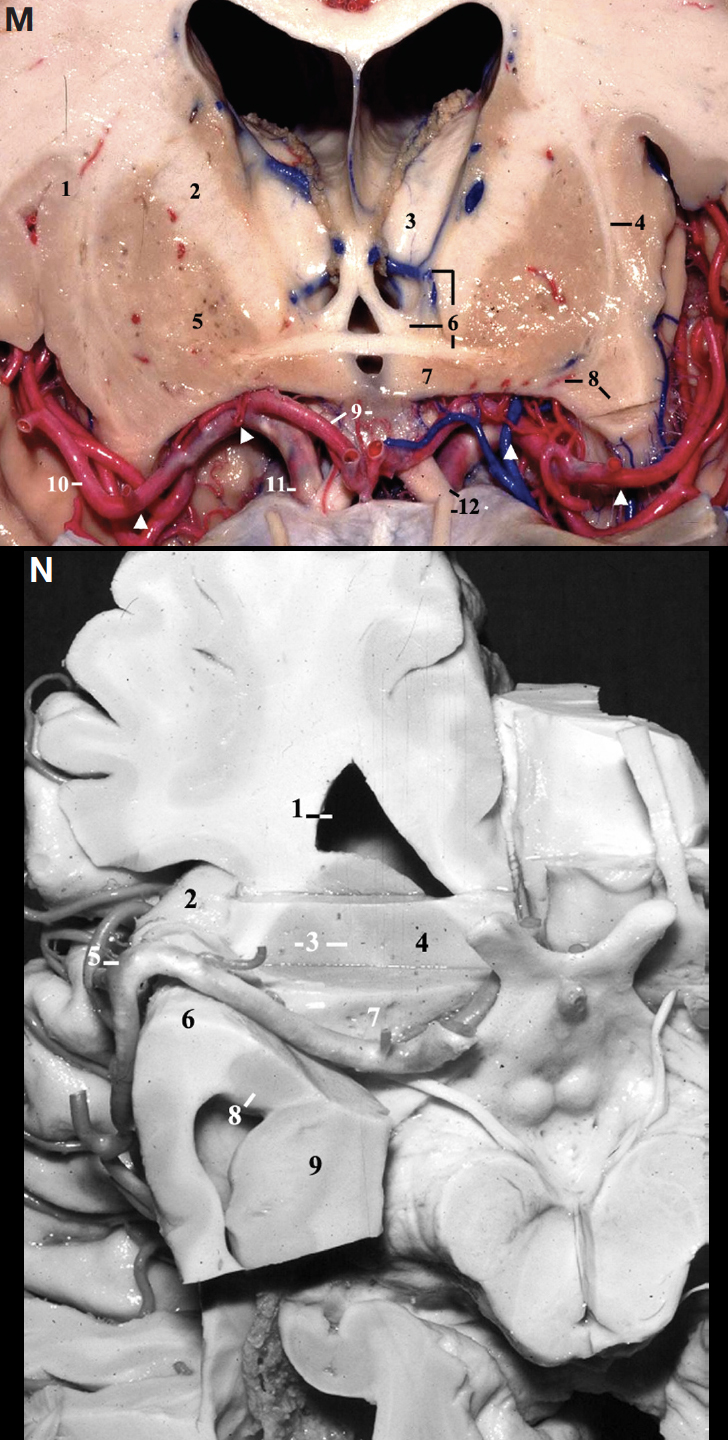The Insula and Deep Nuclei | Neuroanatomy | The Neurosurgical Atlas