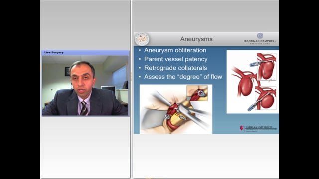 VCC ICG Talk: Advances in Vascular Microsurgery | Grand Rounds/Virtual ...