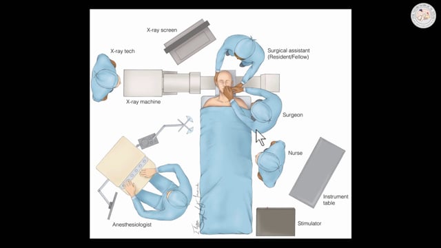 Retrogasserian Balloon Compression Rhizotomy: Technique | Operative ...