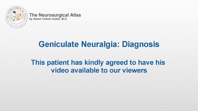 Geniculate Neuralgia: Diagnosis | Operative Video Cases | The ...