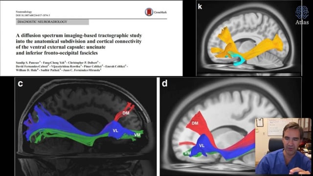 Temporal Lobe Anatomy and Surgery | Grand Rounds/Virtual OR Series ...