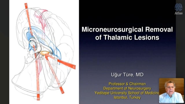 Microsurgical Resection of Thalamic Lesions | Grand Rounds/Virtual OR ...