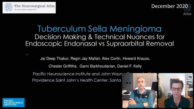 Tuberculum Sella Meningioma | Grand Rounds/Virtual OR Series | The ...