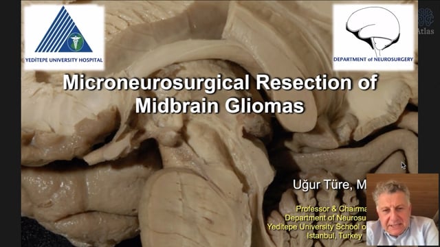 Microneurosurgical Resection of Midbrain Gliomas | Grand Rounds/Virtual ...